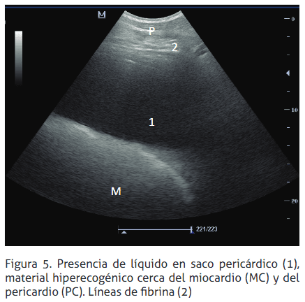 Reticulopericarditis traumática: reporte de un caso | Engormix