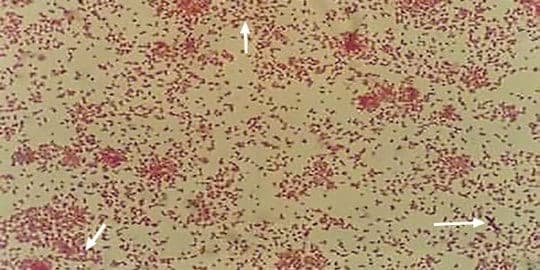 Cólera aviar en aves de corral | Engormix