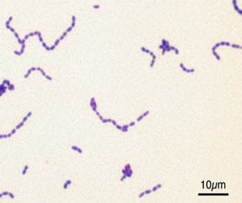 Bacteriologia en el complejo respiratorio de las aves - Engormix